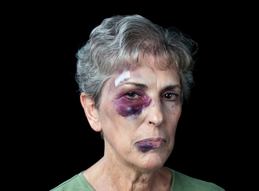 Nursing Home Abuse and Neglect Lawyers – Omaha NE - High & Younes ...